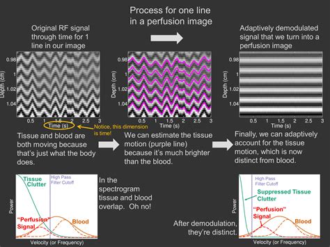 Perfusion Imaging Biomedical Elasticity And Acoustic Measurement Lab