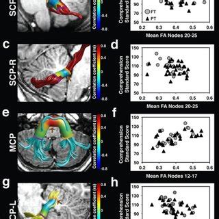 FA Of The Left SCP MCP And Left ICP Is Associated With Decoding Download Scientific Diagram