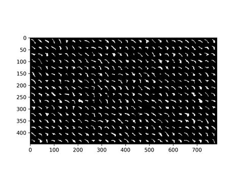 Medical Image Datasets TorchIO