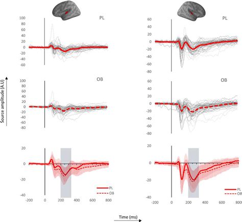 Source Waveforms In The Left And Right Transverse Temporal Gyrus For