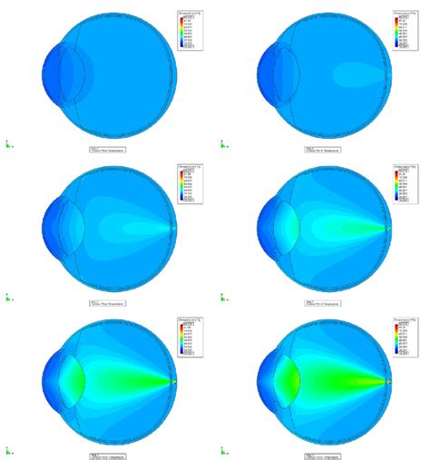 Evolution Of Temperature Distribution In The Whole Eye After T 0 Ms