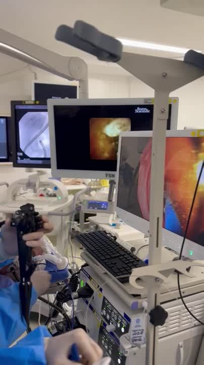 Enteroscopy Ercp Cholangioscopy With Basket Intrahepatic Lithiasis