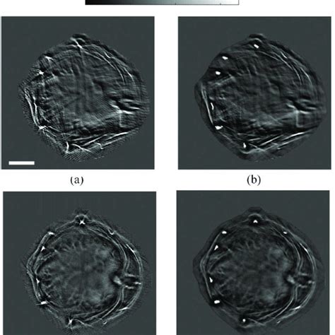Pdf Streak Artifact Suppression In Photoacoustic Computed Tomography Using Adaptive Back