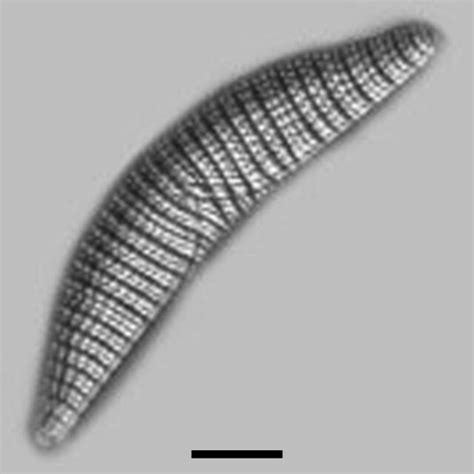 Epithemia Genera Diatoms Of North America