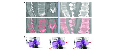 shape prior based segmentation in pipeline 2 a region based