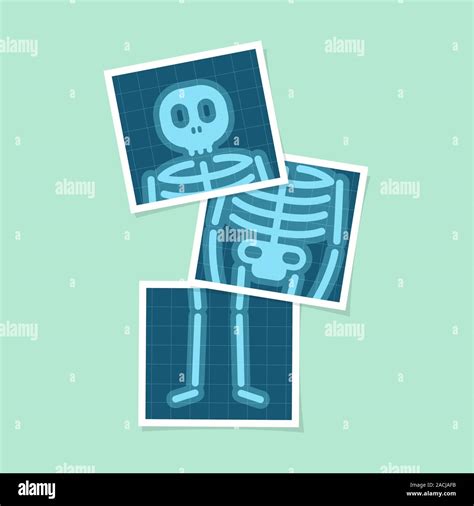 Top 110 X Ray Images Cartoon