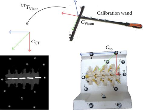 rotation estimation based on multiresolution strategy using spinal
