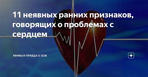 11 неявных ранних признаков говорящих о проблемах с сердцем Мифы и правда о ЗОЖ Дзен