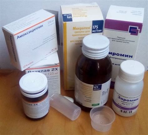 Антибиотики при ангине: польза или вред - ЛОР клиника в Чертаново