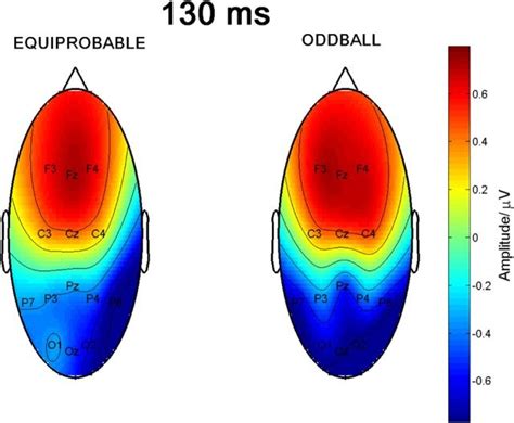 Scalp Potential Maps Of The Ms Component Back Projected To The