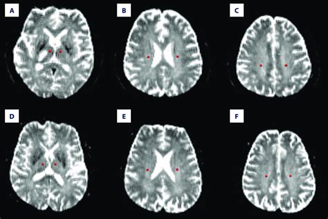Definition Of Regions Of Interest Rois Were Defined A 4 Voxel Circle Download Scientific