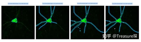 利用segment Anything进行细胞分割 知乎