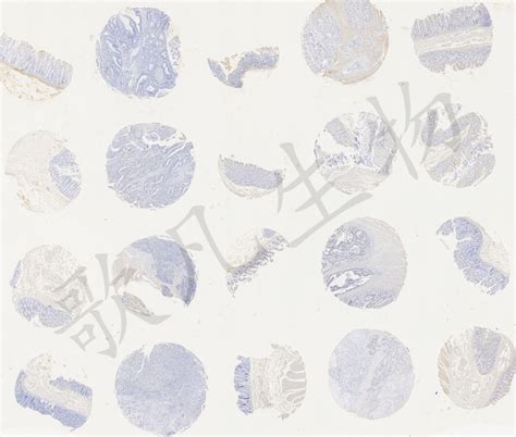 免疫组化（组织芯片） 上海歌凡生物科技有限公司，欢迎您！