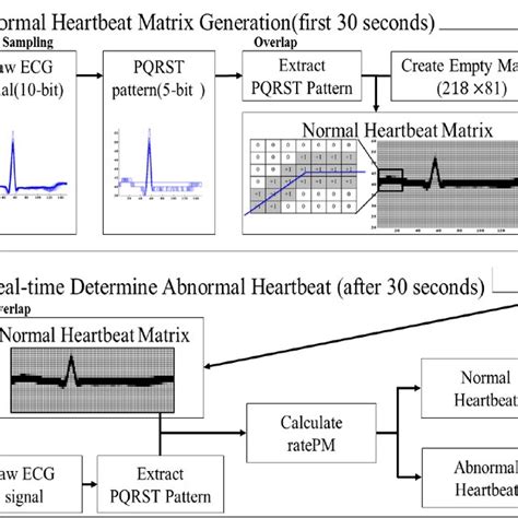 block diagram of the r peak detection process download scientific