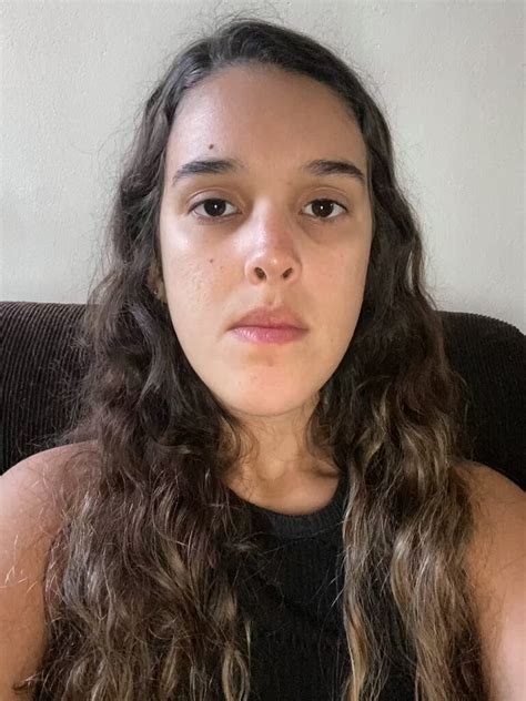 Facial Skin Condition Dataset Unidata Pro