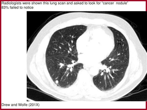 Ppt 3 Selective Attention Selective Attention Attending To Part Of The Environment While