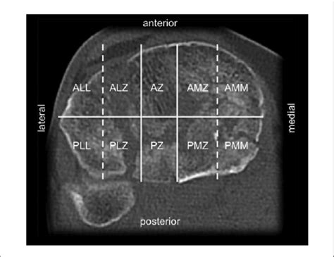 10 Segment Classification According To Krause Segments All