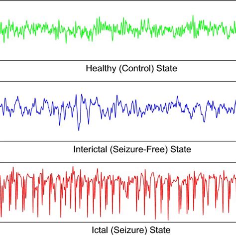sample eeg signals for a healthy control b interictal
