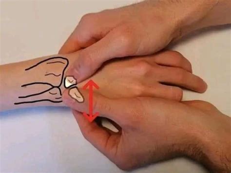 Dr Sana Sarwar On Linkedin Mobilizationtechniques