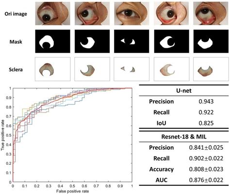 Performance Of The Ai Prediction Model The Upper Part And The First Download Scientific