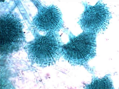 Aspergillus Microscopic