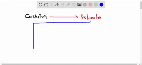 SOLVED The Corpus Callosum Has A Special Function In The Structure Of The Brain What Is This