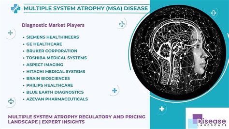 Demystifying Multiple System Atrophy Msa A Comprehensive Overview