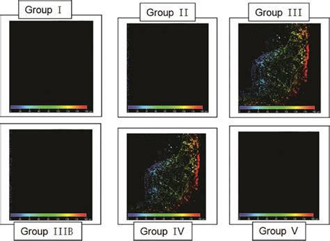 Evaluation Of Enterococcus Faecalis Adhesion Penetration And Method