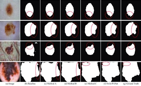 Visual Comparisons Of Skin Lesion Segmentation Results Produced By