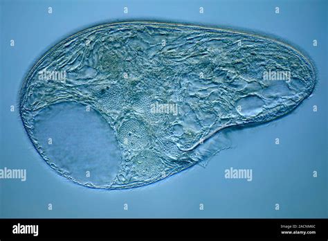 Blepharisma Protozoan Differential Interference Contrast Micrograph Of