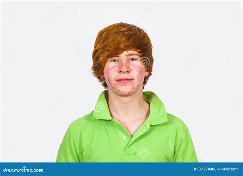 Aantrekkelijke Jongen In Puberteit Stock Foto Image Of Puber Uitdrukking