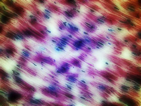 Cardiac Muscle Light Micrograph Stock Image C Science Photo Library