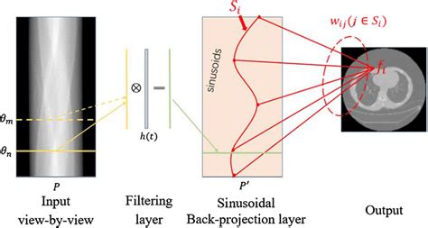 The Structure Of Ct Reconstruction Network Based On Sinusoidal Connections Download Scientific