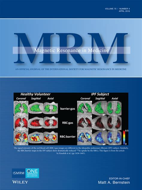 Variable Flip Angle T1 Mapping In The Human Brain With Reduced T2 Sensitivity Using Fast
