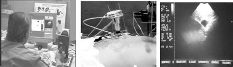 A Doctor And The Haptic Device Master Site B Slave Robot On Download Scientific Diagram