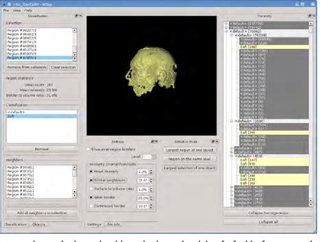 Figure 4 From Interactive Segmentation Of Volume Data Using Watershed Hierarchies Semantic Scholar