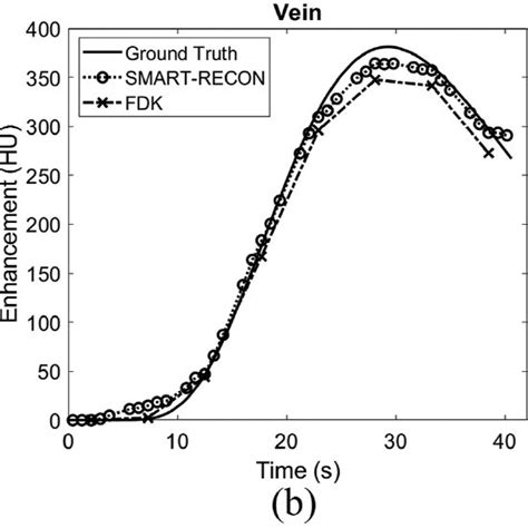 An Example Contrast Uptake Curve From An Artery Voxel A A Vein Voxel