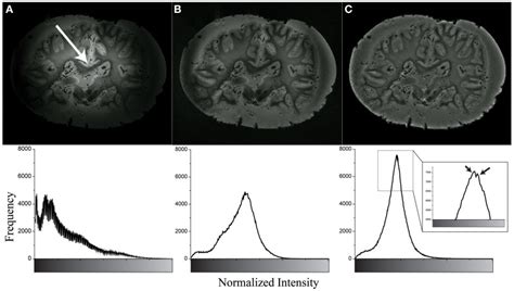 Example Of Inhomogeneity Correction Of Original Image A Using N4 Bias