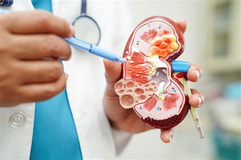 Understanding Glomerular Disease Causes Symptoms And Treatment Options