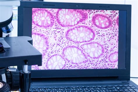 Super Resolution Fourier Ptychographic Microscopy Avantier Inc