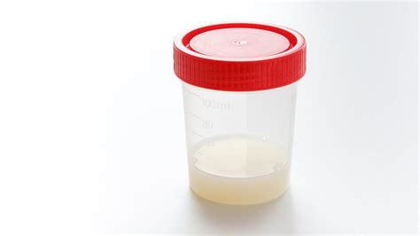 Желтая сперма у мужчин почему и что делать причины