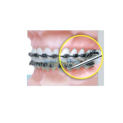 Buy Leone Class Ii Corrector Kit 200 Gms Online At Best Price