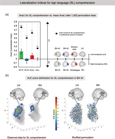 Lateralization Indices For Sign Language Sl Comprehension A Aveli