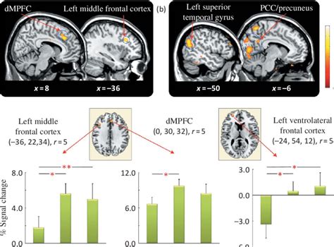 The Results Of Resting State Regional Homogeneity A Increased