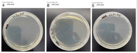 Effectiveness Of Three Rotary File Systems On Enterococcus Faecalis In Single Rooted Teeth An