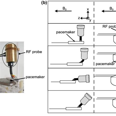 RF Probe Positioning During MRI Experiments A Picture Of An RF Probe Download Scientific