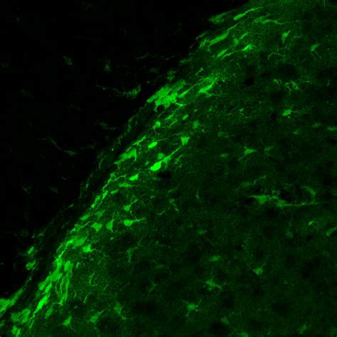 Gensat Project At Rockefeller University Mouse Brain Atlas Image Navigator
