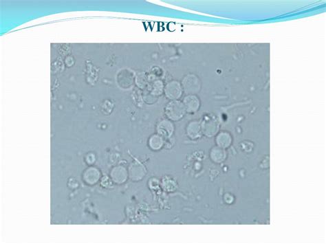 Stool Exam Rbc At Henry Beverly Blog