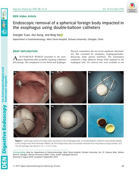 Pdf Endoscopic Removal Of A Spherical Foreign Body Impacted In The
