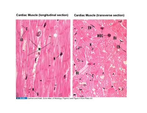 Cardiac Muscle Cross Section